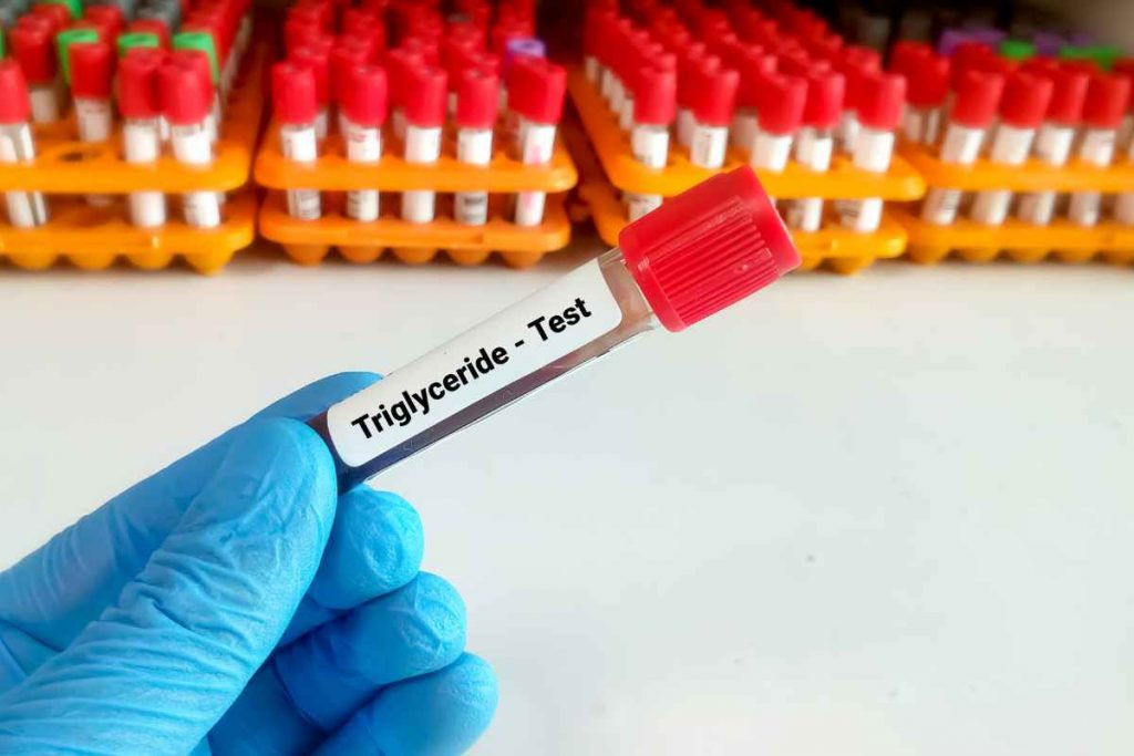 Trigliceridi: valori subito in ordine se usi questo trucco svelato dai ...